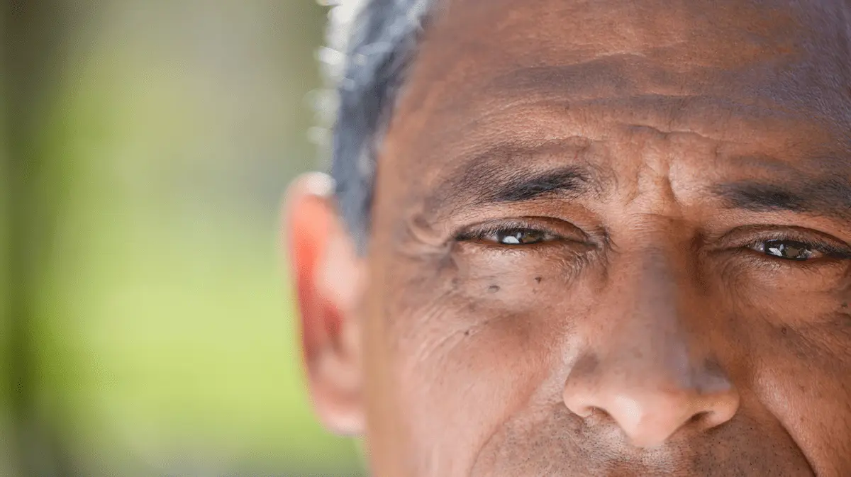 Pálpebra caída: por que acontece e como tratar com segurança